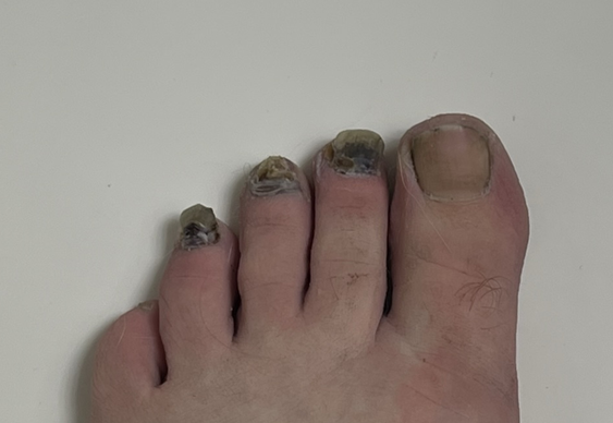 The Protector Vanishes | Eigenblogger